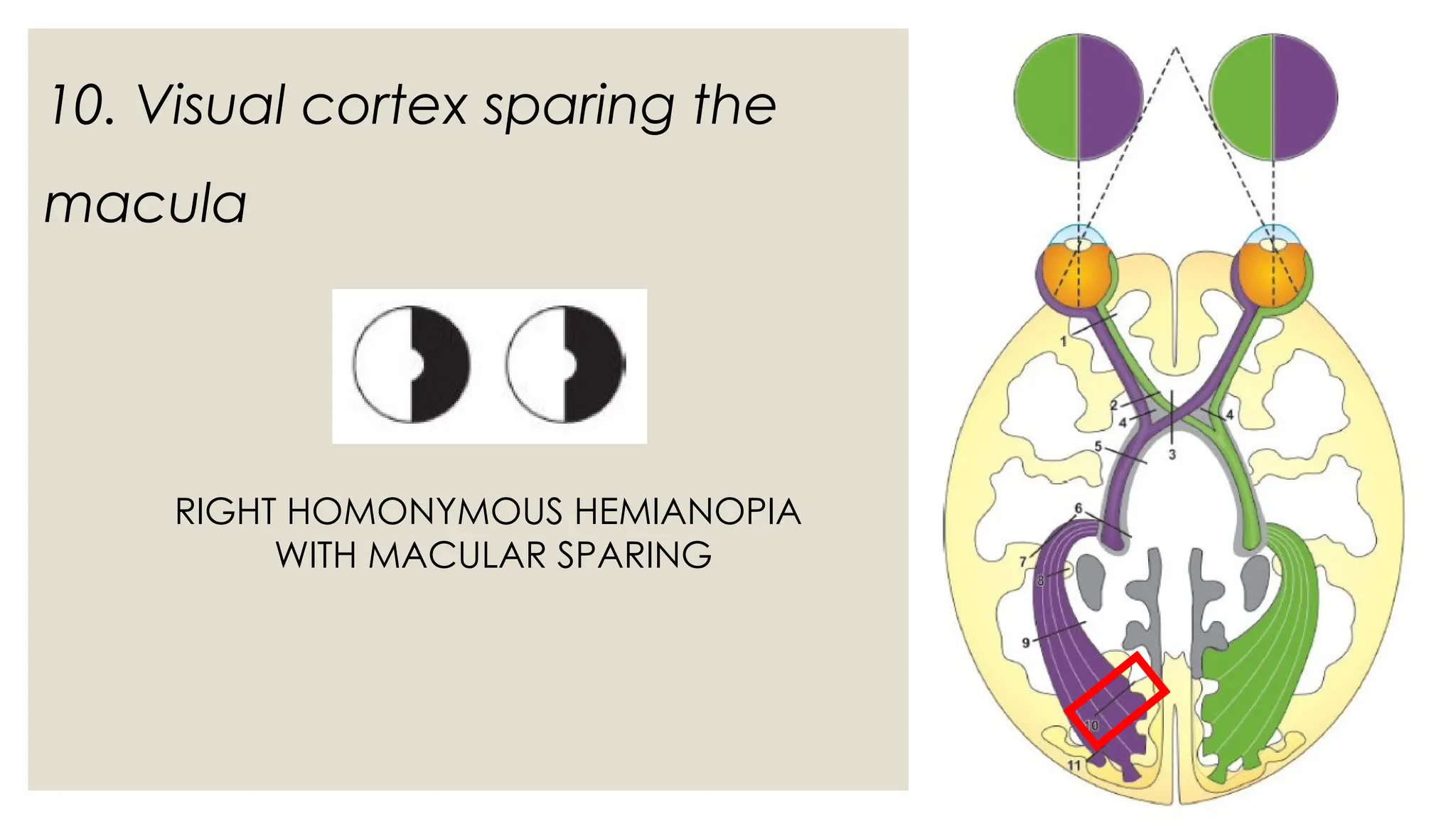 VISUAL PATHWAY and its related pathology | PPTX