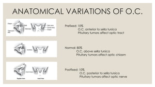 VISUAL PATHWAY and its related pathology | PPTX