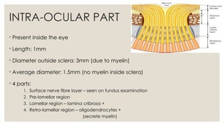 VISUAL PATHWAY and its related pathology | PPTX