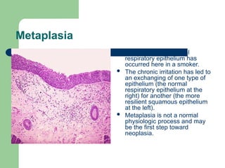 01-CELL INJURY 1.ppt for pathology it is easy | PPT
