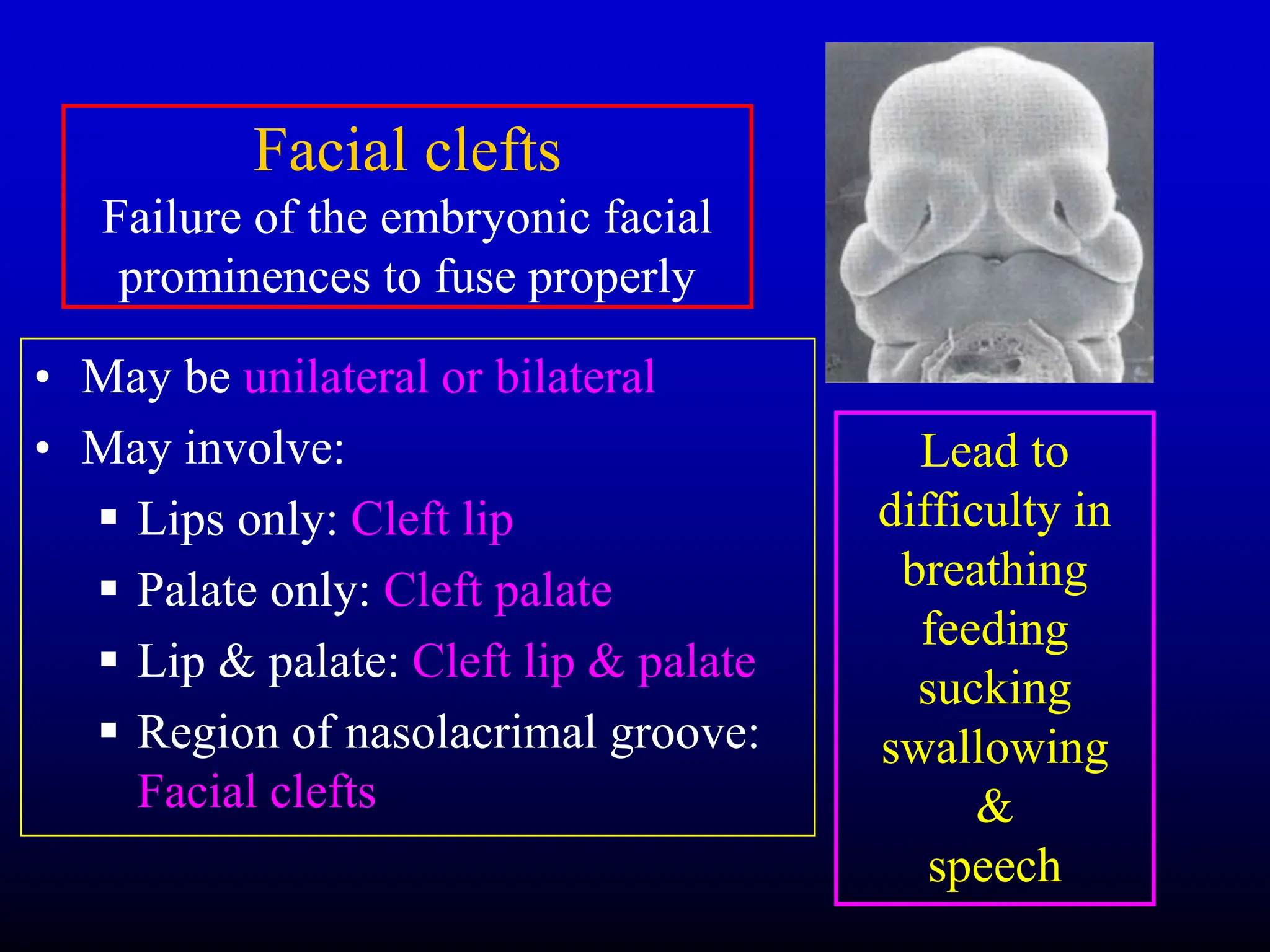 Development of Face, oral cavity and pharyngeal arches .ppt