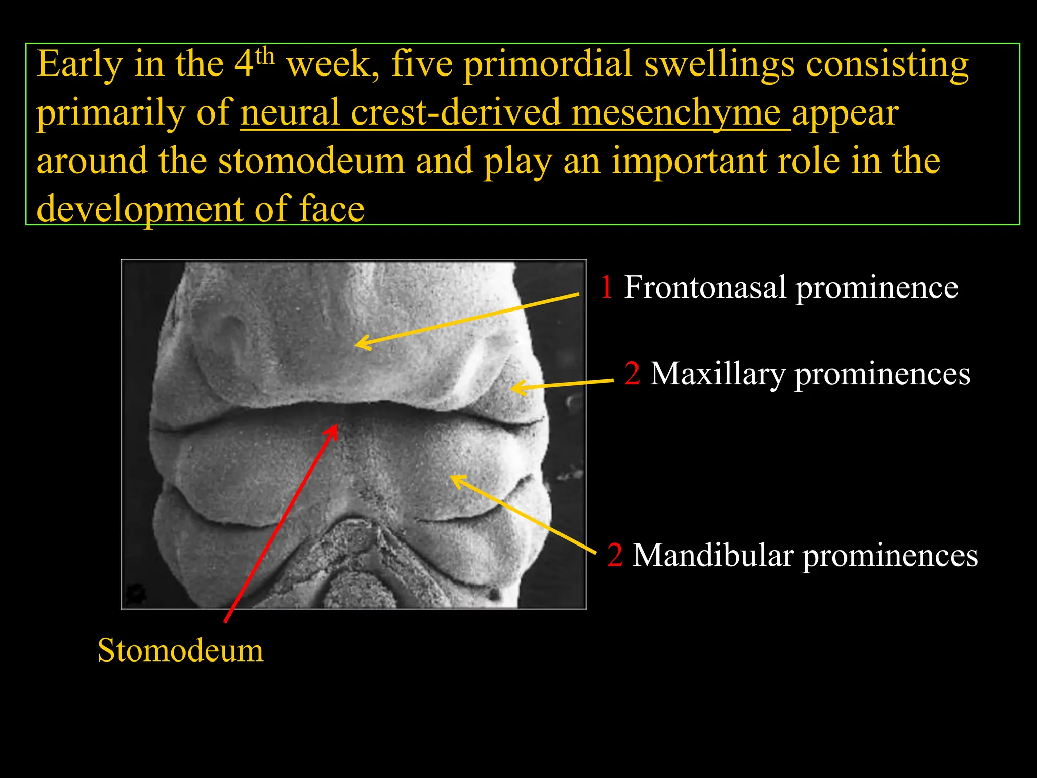 Development of Face, oral cavity and pharyngeal arches .ppt | Ear, Nose ...