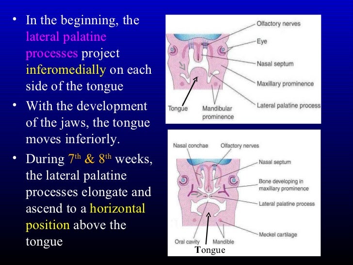 Transverse Palatine Folds