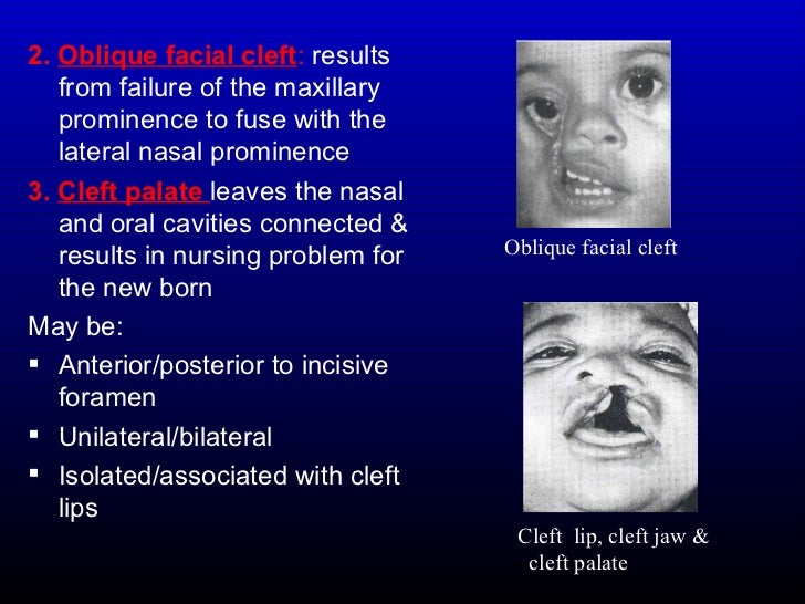 Development of the Face, Oral Cavity & Pharyngeal arches