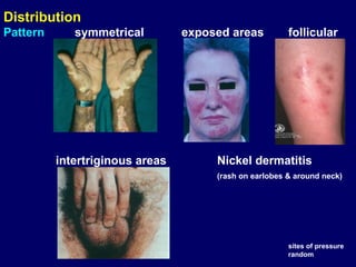 Diagnosis of skin disorders and how to deal.ppt