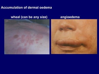 Diagnosis of skin disorders and how to deal.ppt
