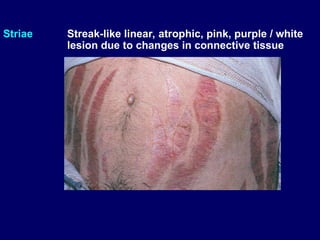 Diagnosis of skin disorders and how to deal.ppt