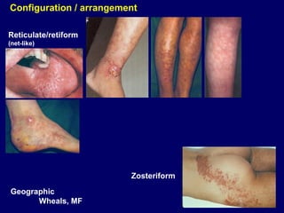 Diagnosis of skin disorders and how to deal.ppt