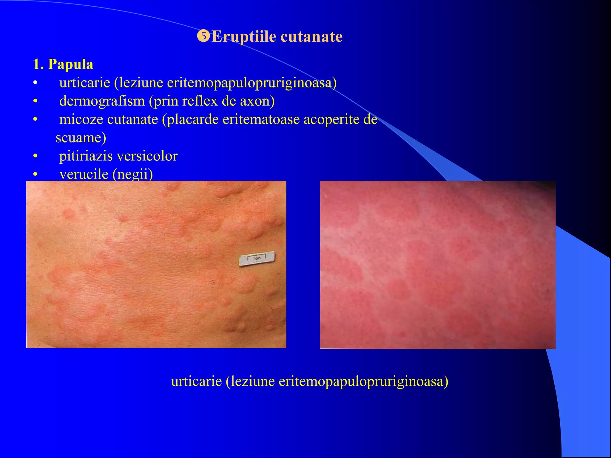 01 - general - curs 5 - dermatologie.ppt