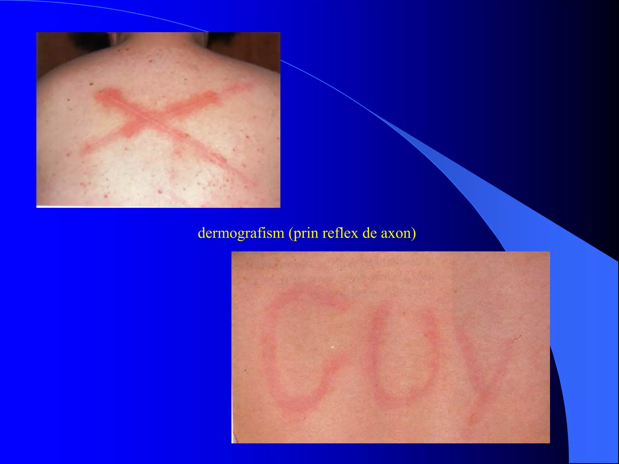 01 - general - curs 5 - dermatologie.ppt