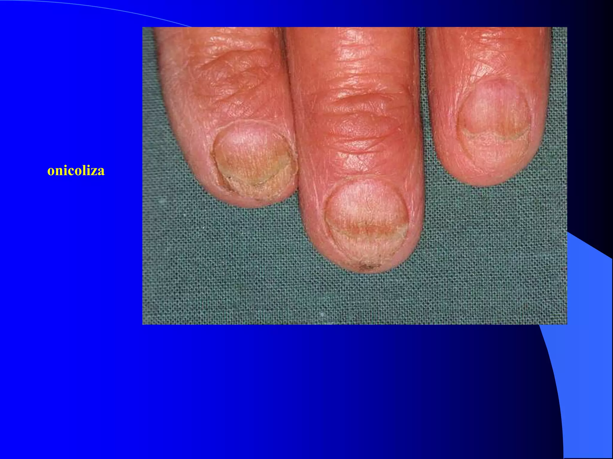 01 - general - curs 5 - dermatologie.ppt