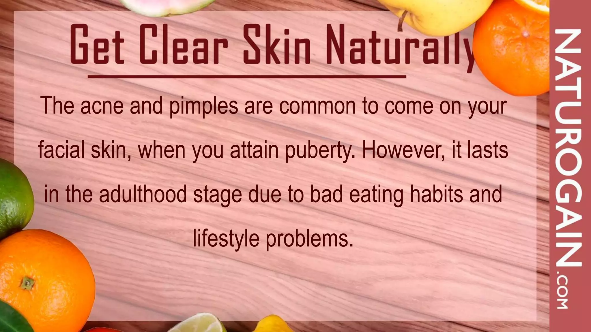Top 20 Foods to Avoid Pimples on Face, Clear Acne Naturally | PPT