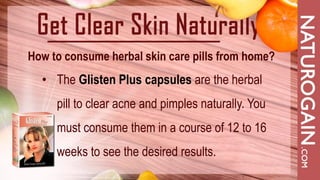 Top 20 Foods to Avoid Pimples on Face, Clear Acne Naturally | PPT