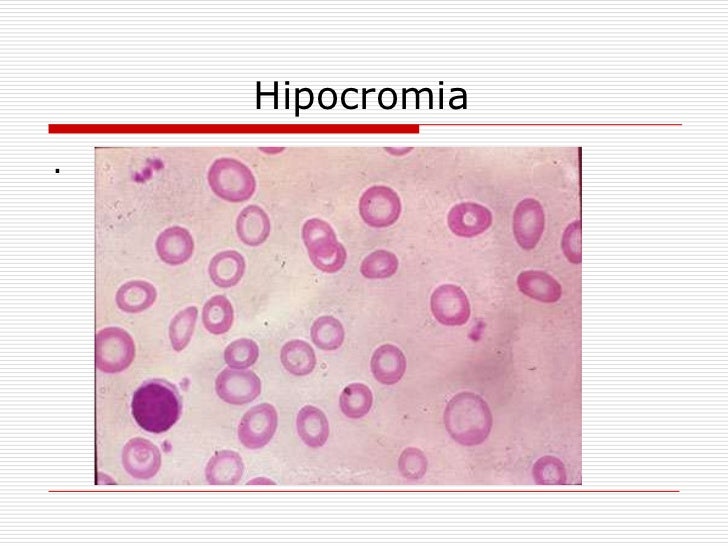 01.hemograma med