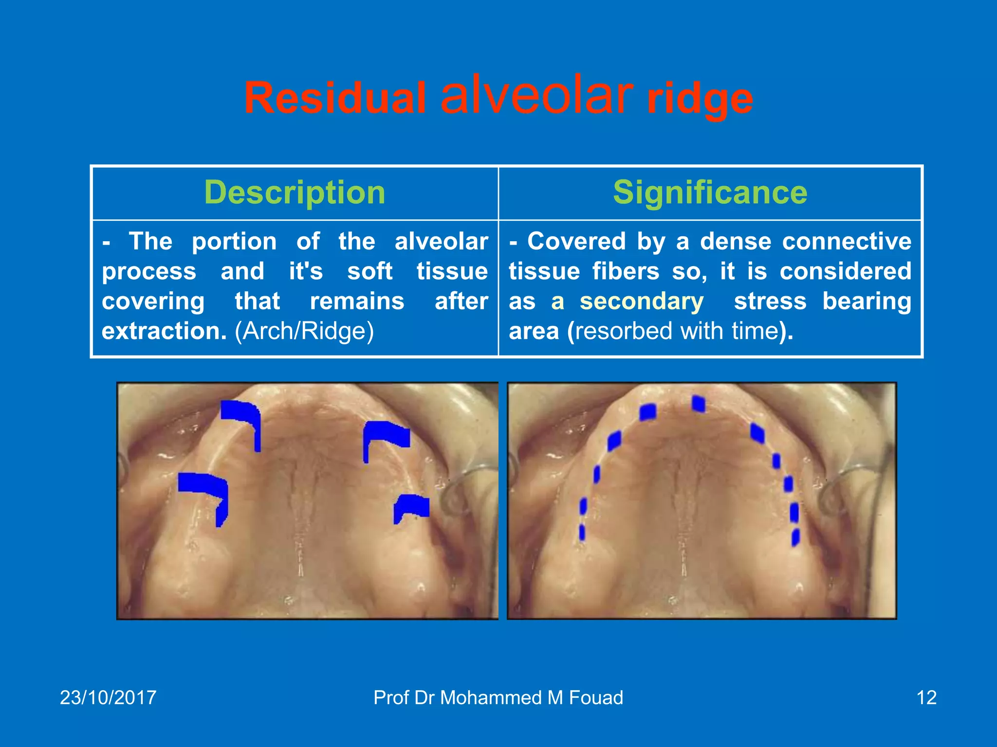 Intraoral Anatomical Landmarks | PDF
