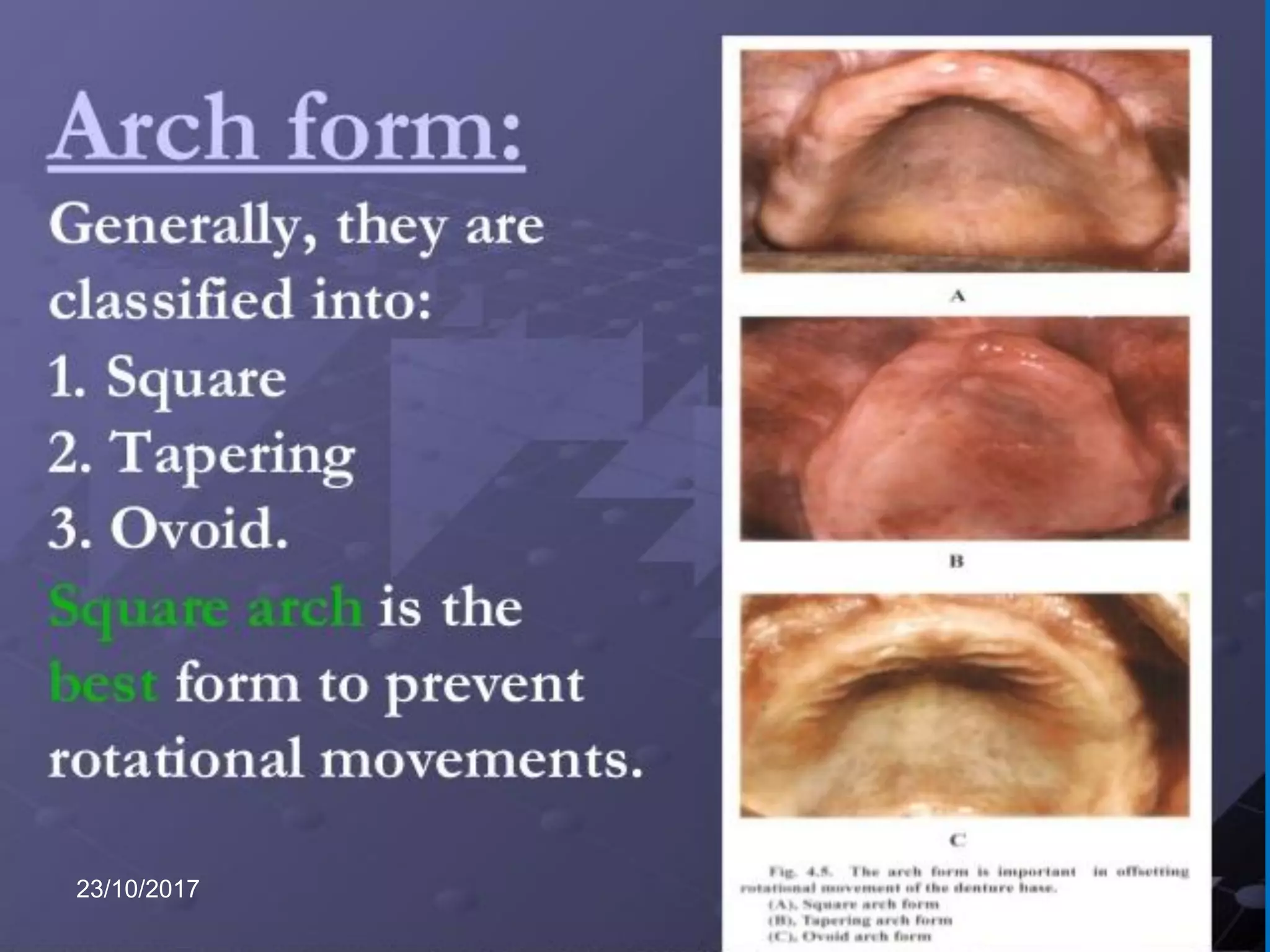 Intraoral Anatomical Landmarks | PDF