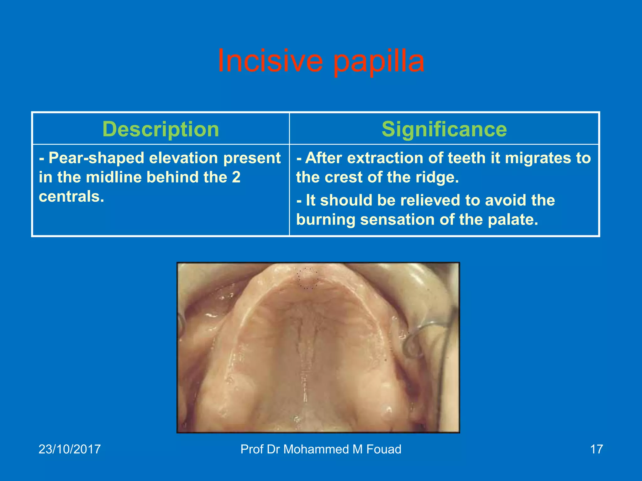 Intraoral Anatomical Landmarks | PDF