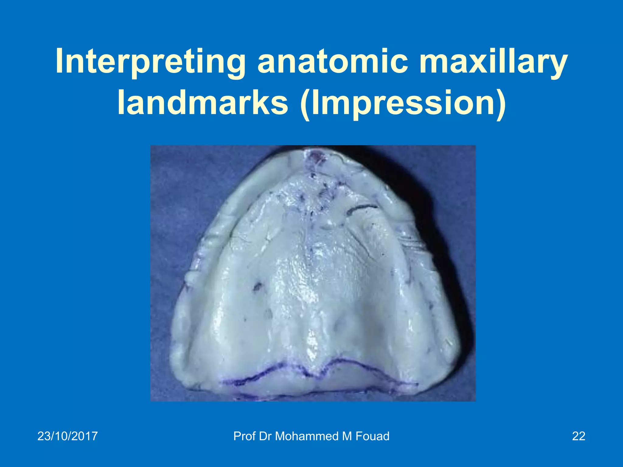 Intraoral Anatomical Landmarks | PDF