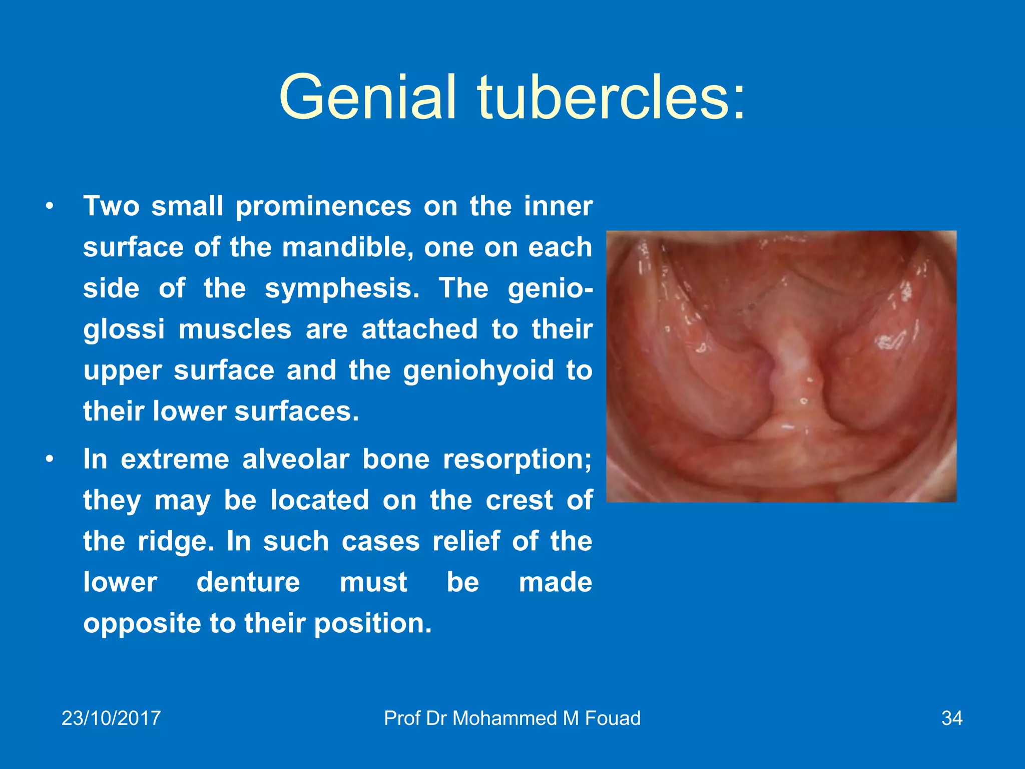 Intraoral Anatomical Landmarks | PDF