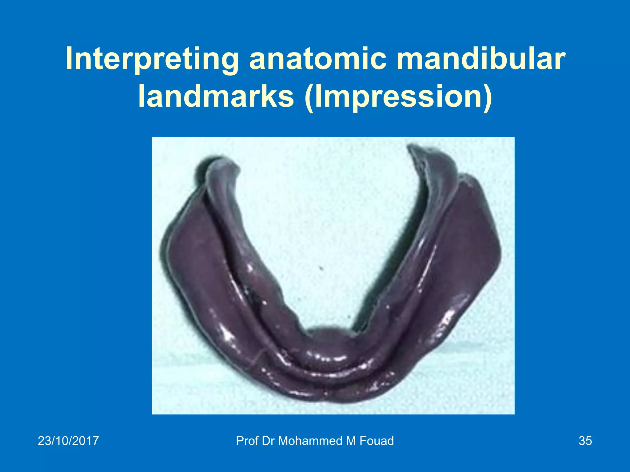 Intraoral Anatomical Landmarks | PDF