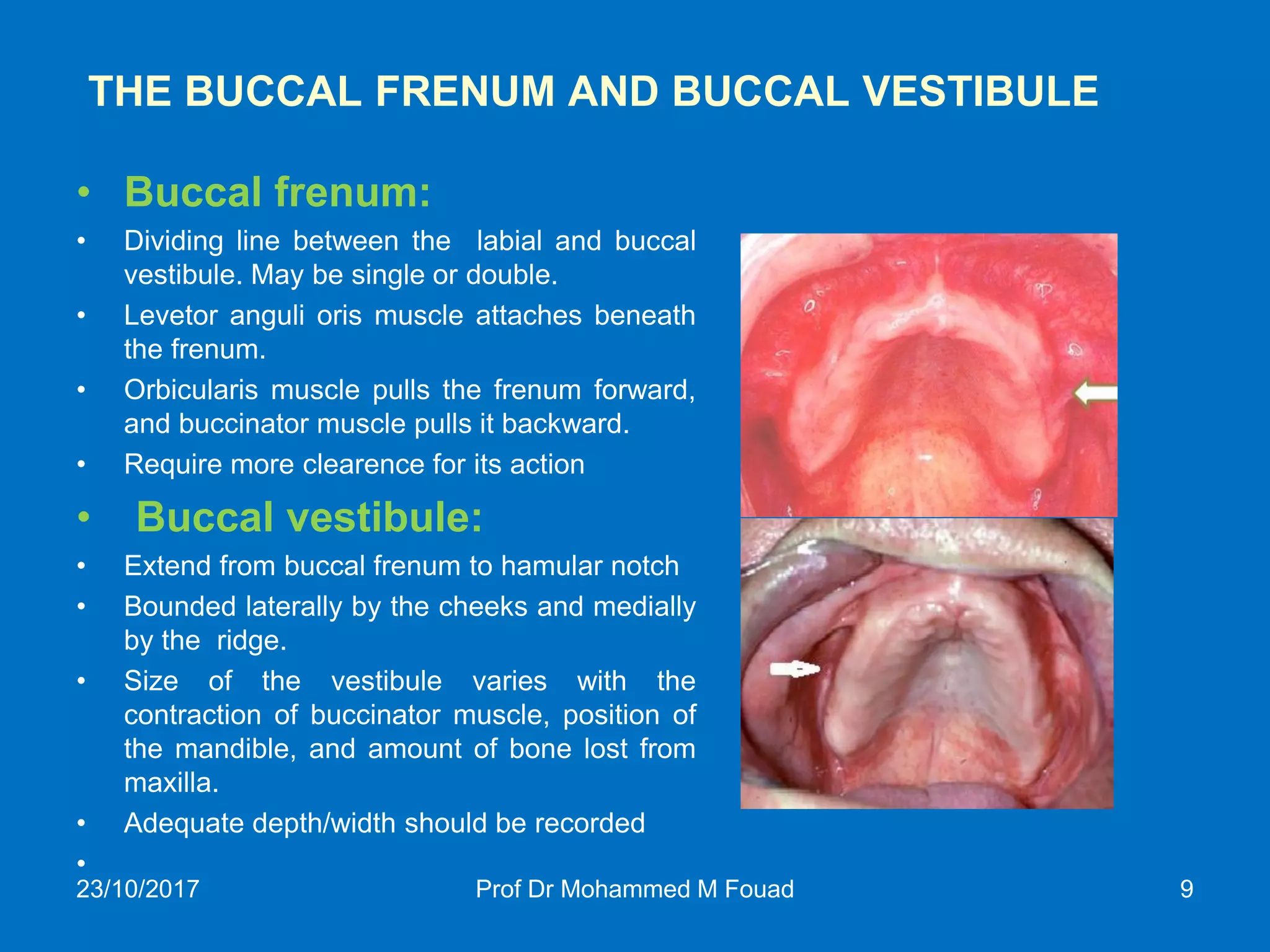 Intraoral Anatomical Landmarks | PDF