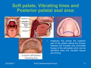 Intraoral Anatomical Landmarks | PDF
