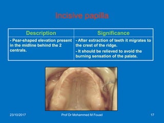 Intraoral Anatomical Landmarks | PDF