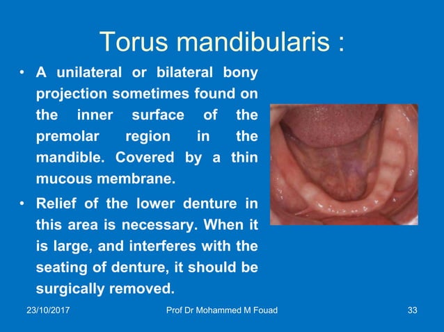 Intraoral Anatomical Landmarks | PDF | Dental Health | Diseases and ...