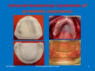 Intraoral Anatomical Landmarks | PDF | Dental Health | Diseases and ...