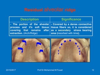 Intraoral Anatomical Landmarks | PPT