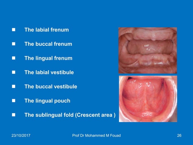 Intraoral Anatomical Landmarks