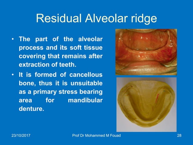 Intraoral Anatomical Landmarks