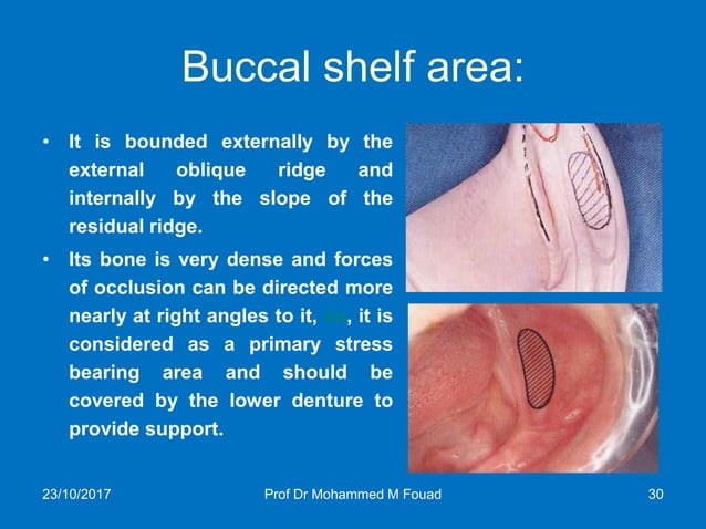 Intraoral Anatomical Landmarks