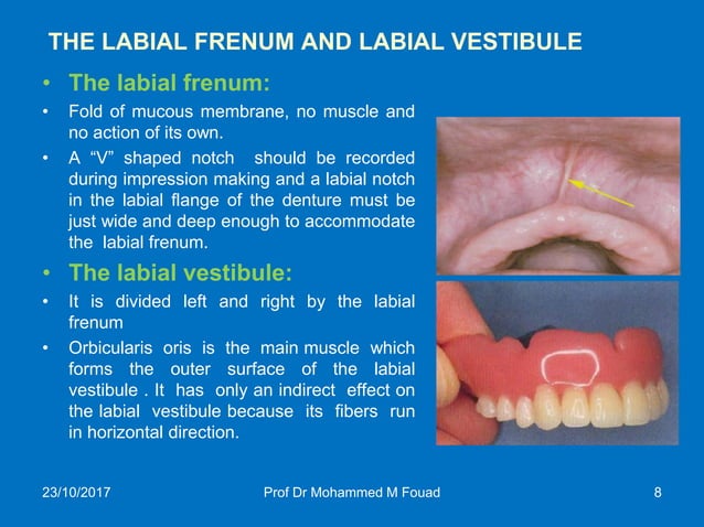 Intraoral Anatomical Landmarks
