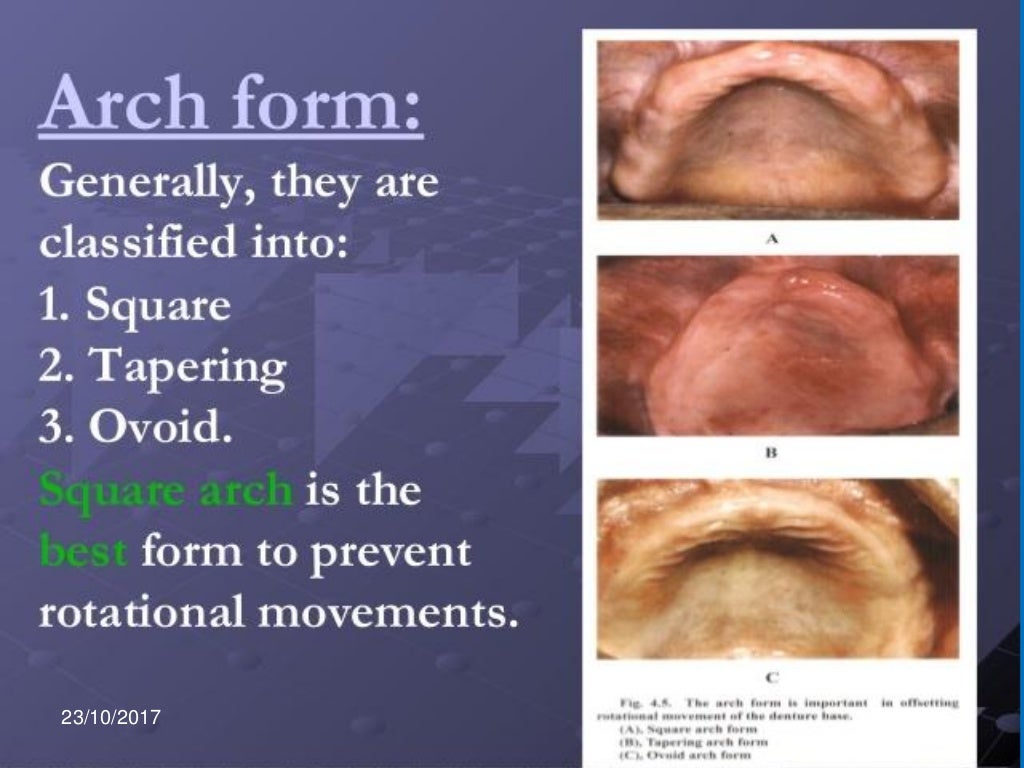 Intraoral Anatomical Landmarks