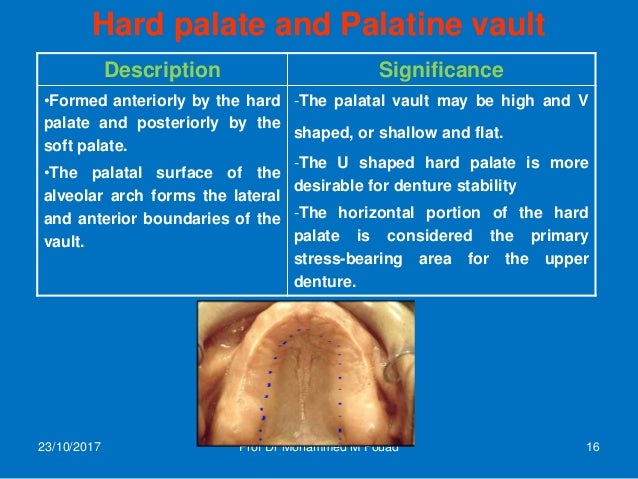 Intraoral Anatomical Landmarks