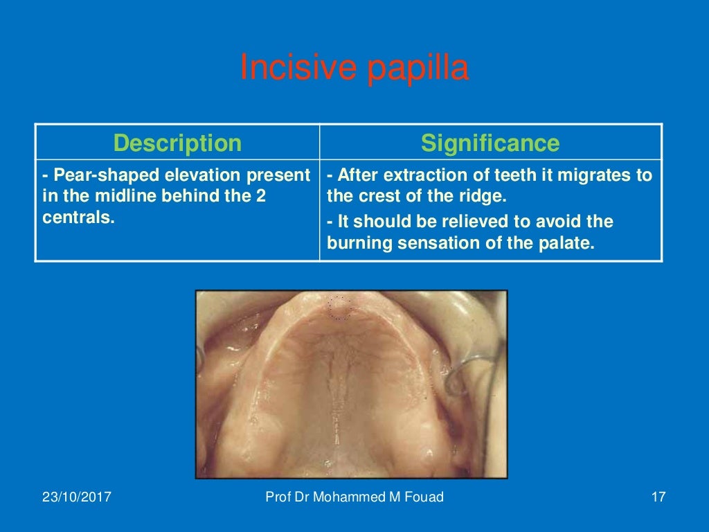 Intraoral Anatomical Landmarks