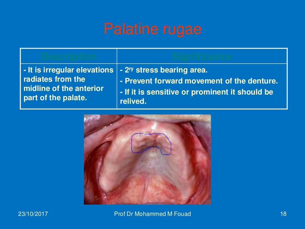 Intraoral Anatomical Landmarks