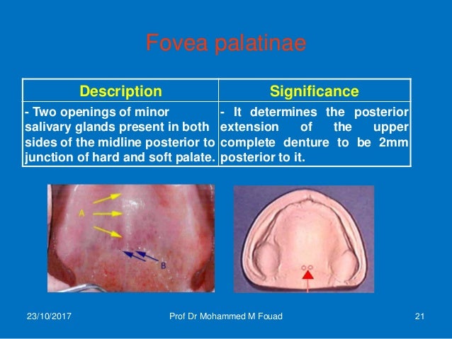 Intraoral Anatomical Landmarks