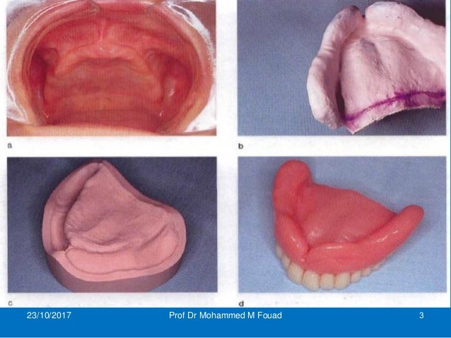 Intraoral Anatomical Landmarks