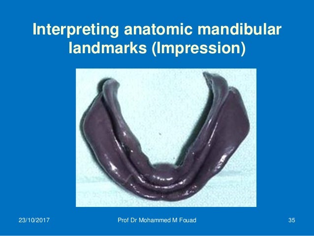 Intraoral Anatomical Landmarks