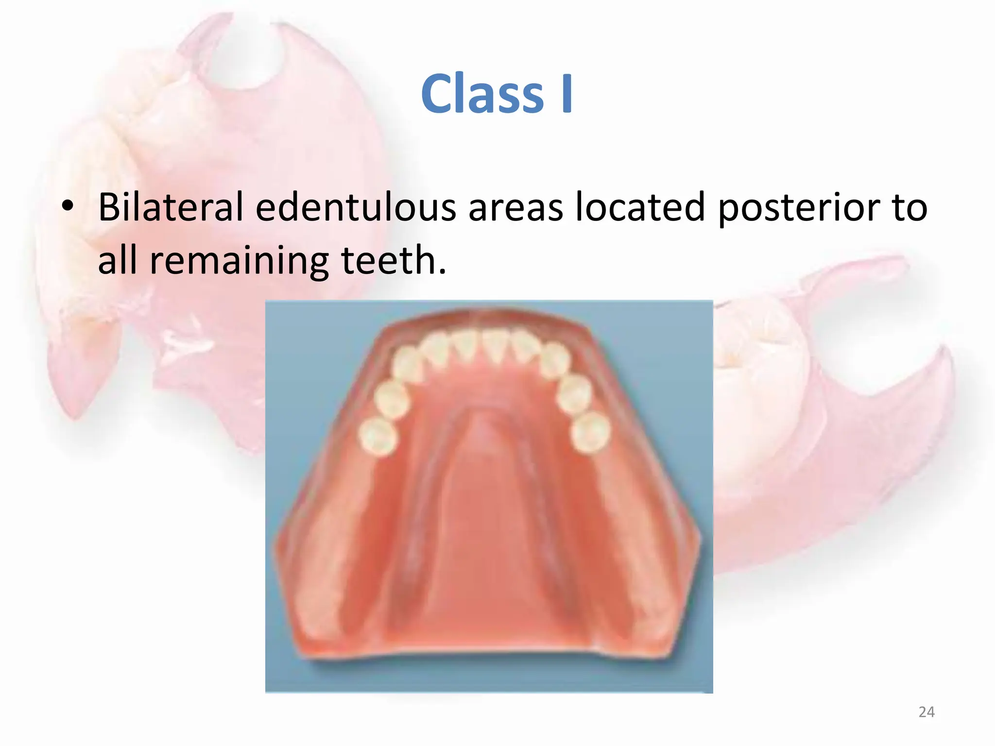 01- INTRODUCTION AND CLASSIFICATION PARTIAL DENTURE.pptx