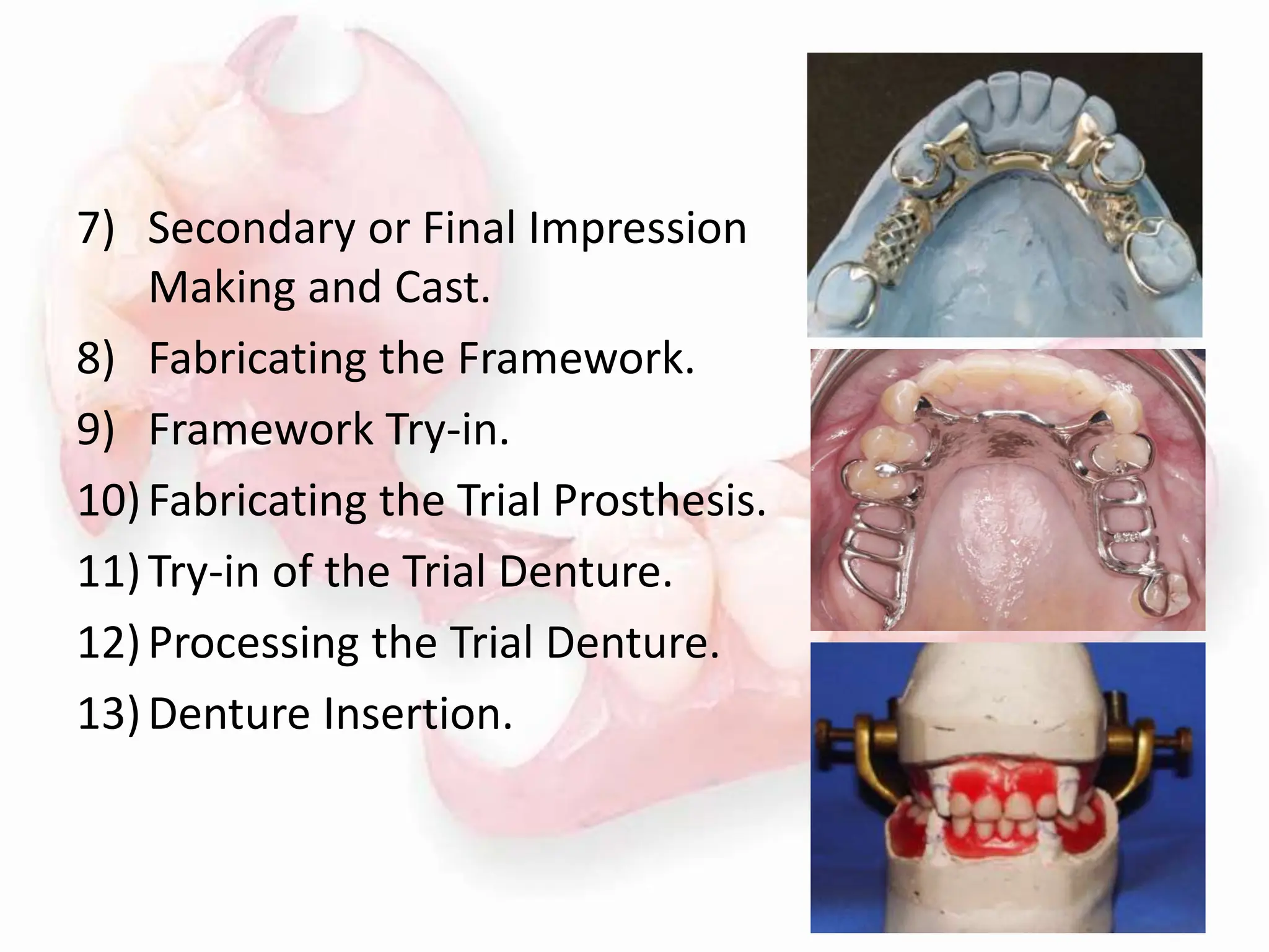 01- INTRODUCTION AND CLASSIFICATION PARTIAL DENTURE.pptx