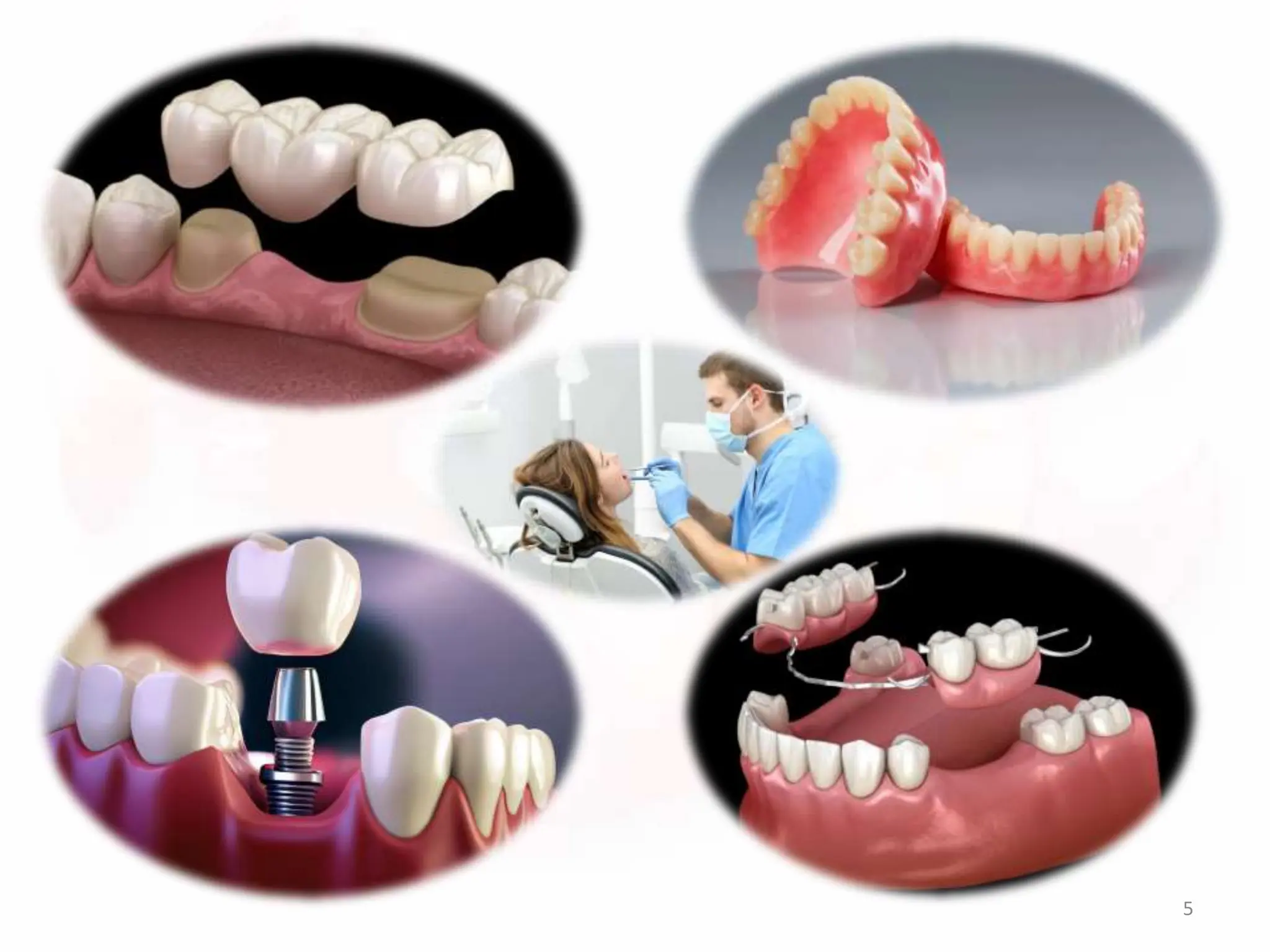 01- INTRODUCTION AND CLASSIFICATION PARTIAL DENTURE.pptx | Dental ...