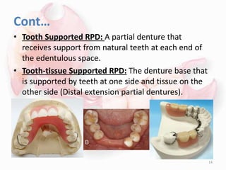 01- INTRODUCTION AND CLASSIFICATION PARTIAL DENTURE.pptx