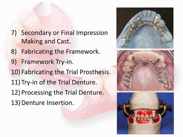 01- INTRODUCTION AND CLASSIFICATION PARTIAL DENTURE.pptx | Dental ...