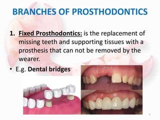 01- INTRODUCTION AND CLASSIFICATION PARTIAL DENTURE.pptx