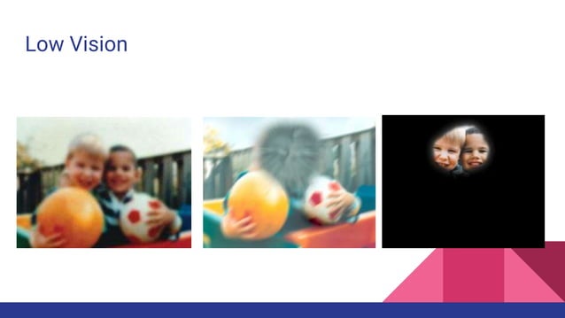 01 - LOW VISION - Introduction to Blindness and Low Vision.pptx | Eye ...