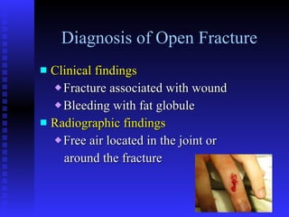 ortho 01 management of open fracture-update by kk 31052010 | PPT