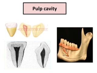 a super explanment 01- Maxillary central incisors | PPTX | Dental ...